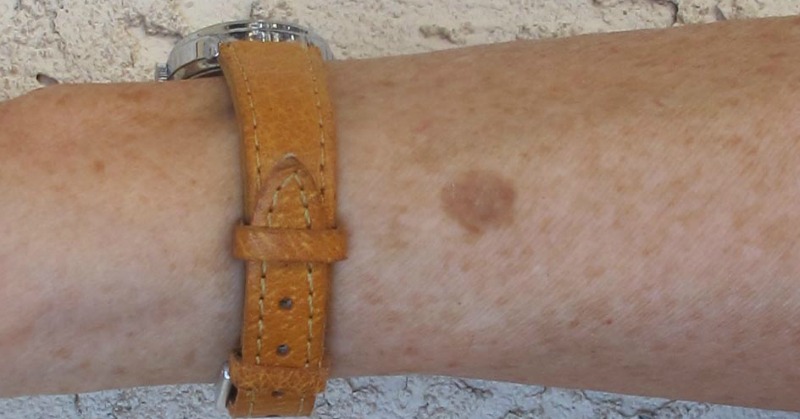 5 Ways to Prevent Age Spots | Butter Nutrition