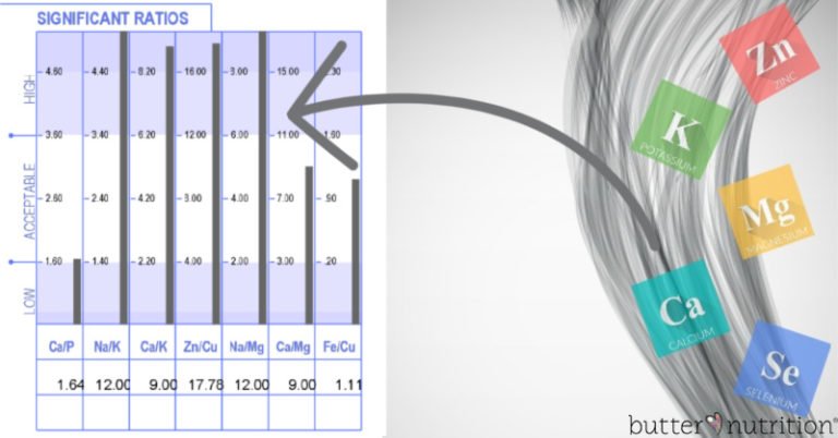 Hair Tissue Mineral Analysis: Significant Ratios | Butter Nutrition