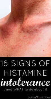 16 Signs of Histamine Intolerance (and WHAT causes it) | Butter Nutrition