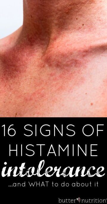 16 Signs of Histamine Intolerance (and WHAT causes it) | Butter Nutrition