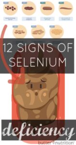 12 Signs of Selenium Deficiency | Butter Nutrition